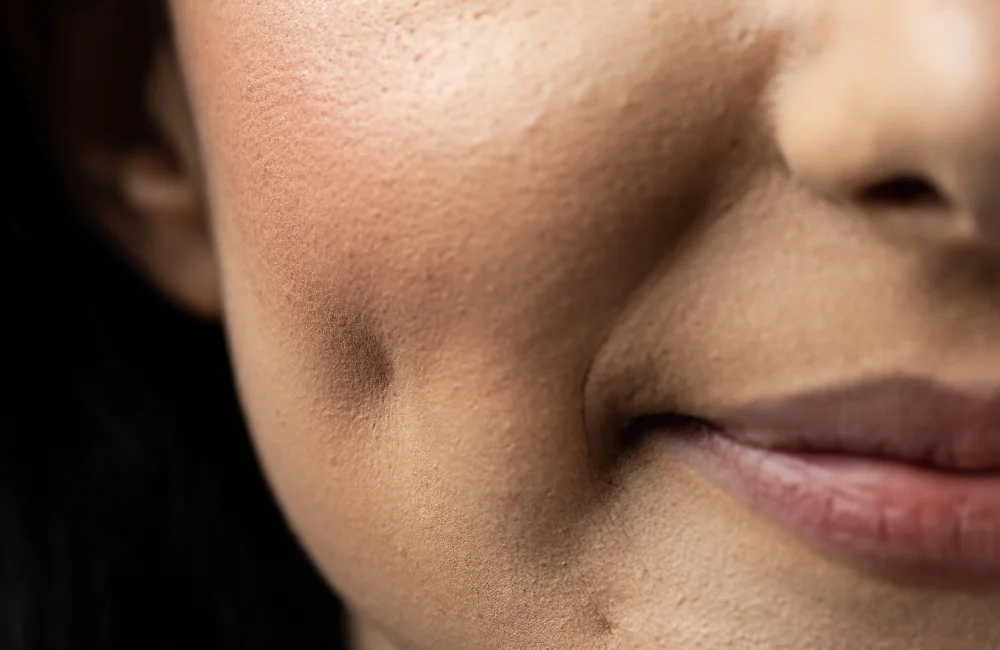 อาการปวดหลังแบบไหน เป็นสัญญาณอันตรายที่ควรพบแพทย์